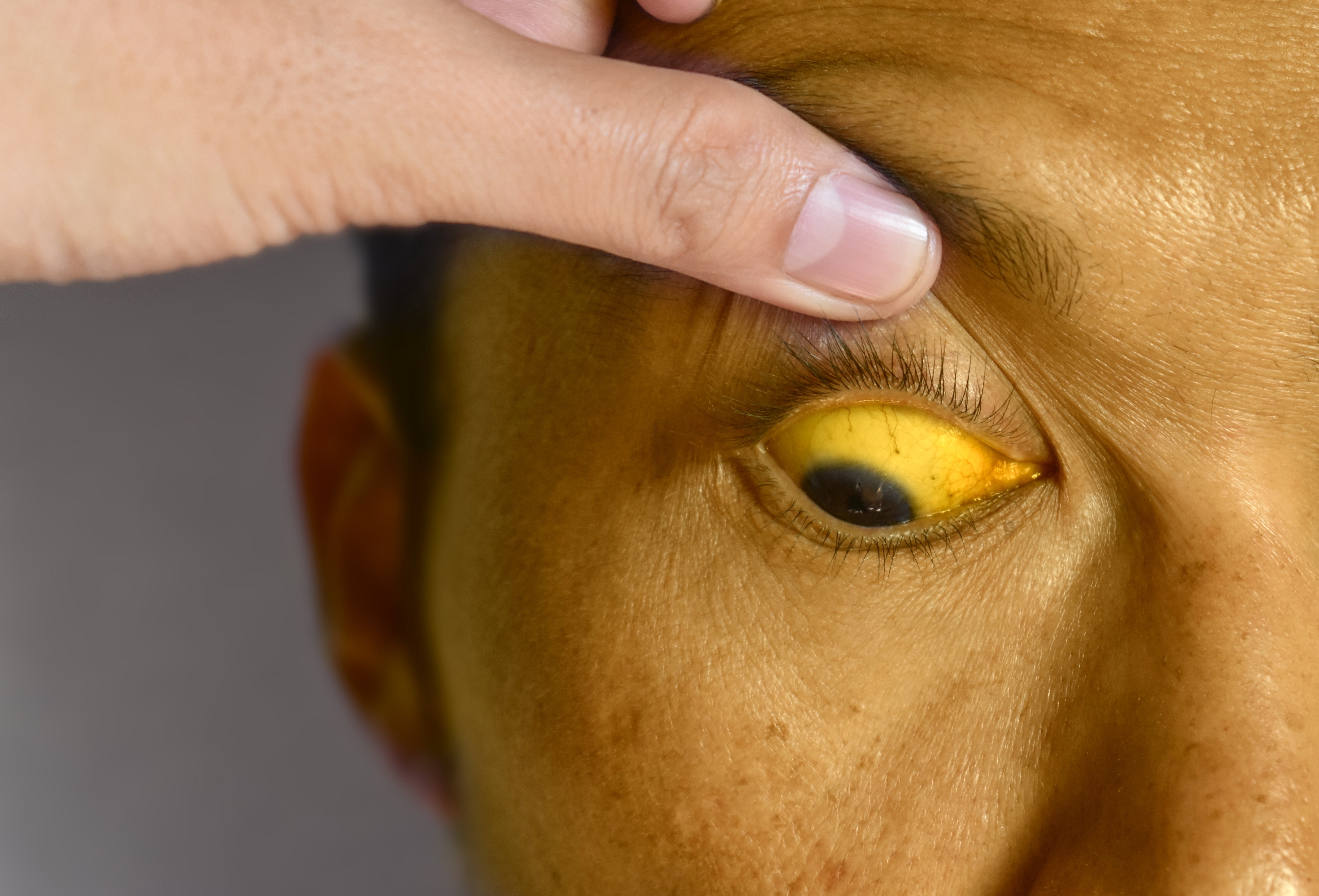 28 'Small' Symptoms You Shouldn't Ignore, Per Doctors