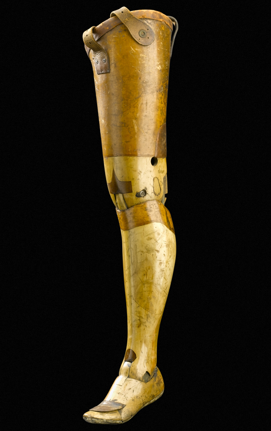 9 Historically Exquisite Artificial Limbs