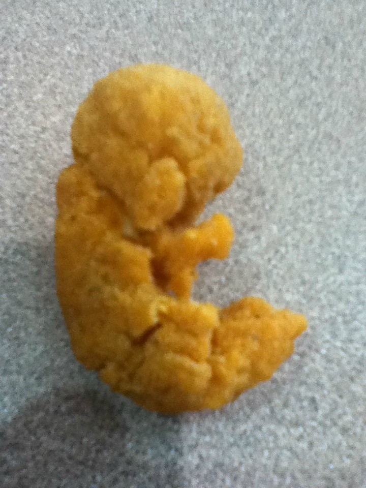 18 Chicken Nuggets That Clearly Prove God Is Real