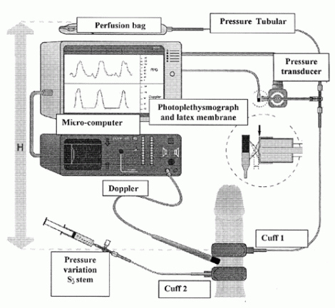 EU Declares "Phallometric Testing" Unethical... Ouch!
