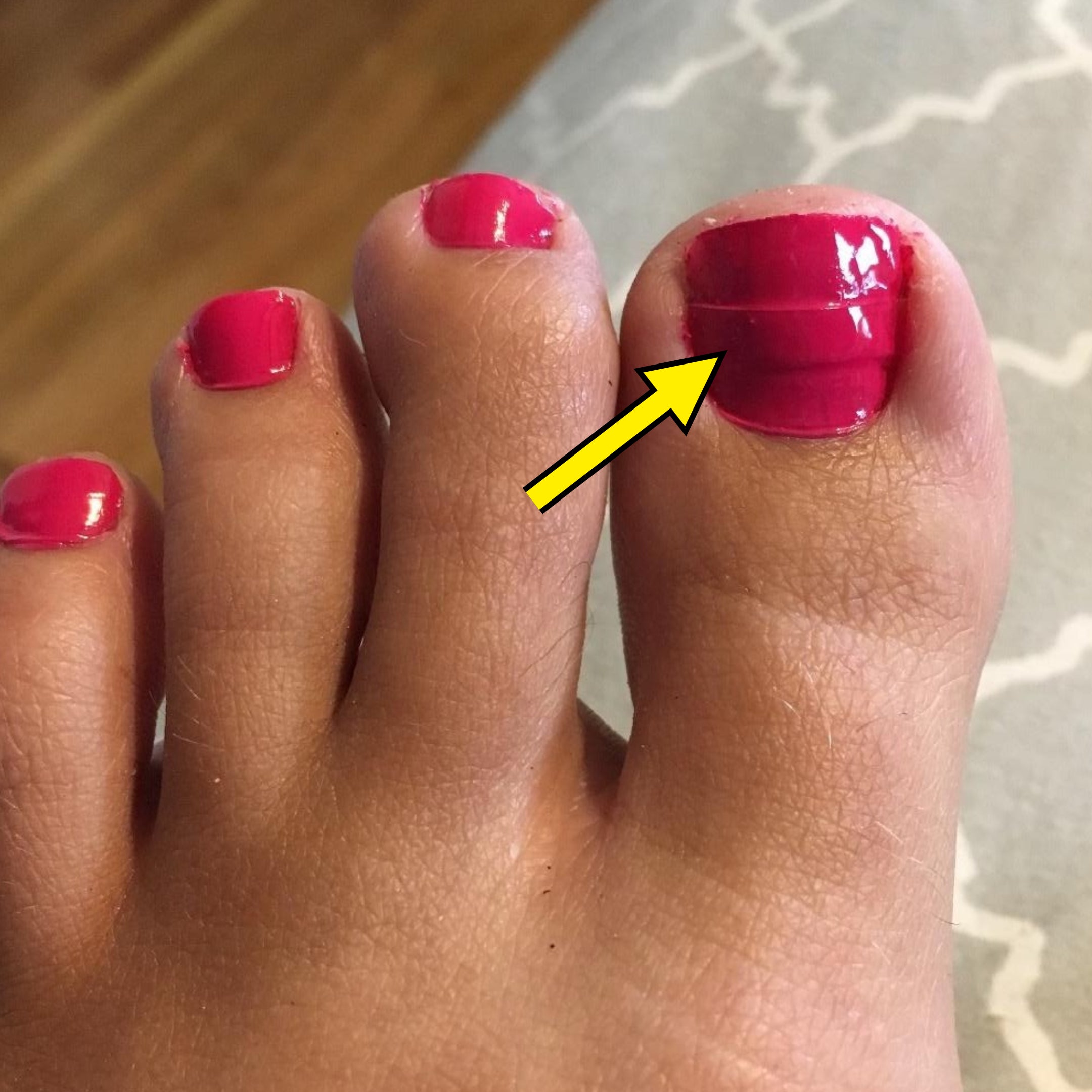 25 Solutions For Unexpected And Quirky Body Issues