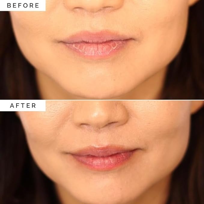 32 Best Lip Masks To Hydrate Your Pout In 2025