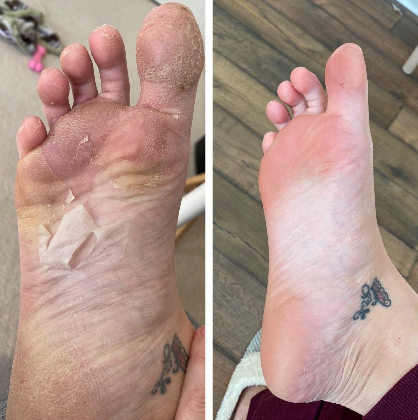 29 Products With Gnarly Before And After Pics