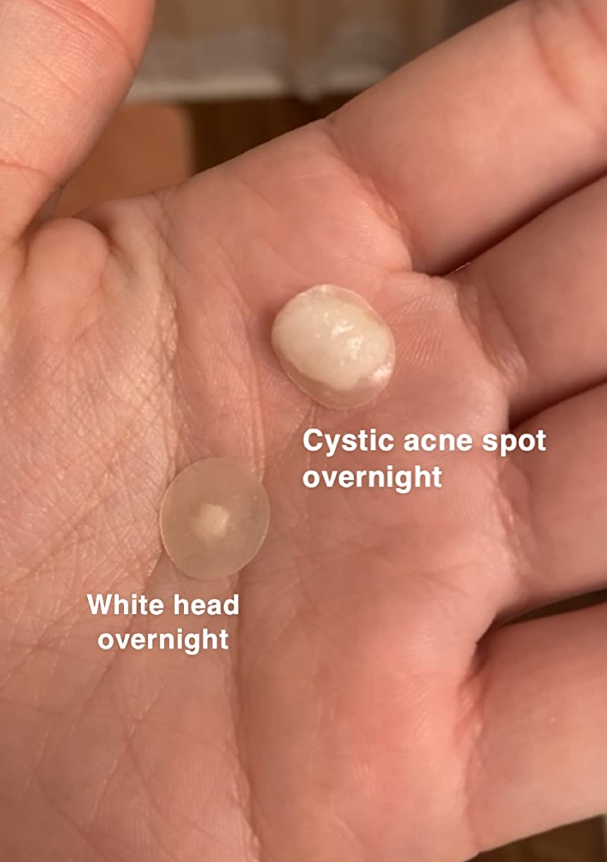 22 Skincare Products Reviewers With Hormonal Acne Swear By