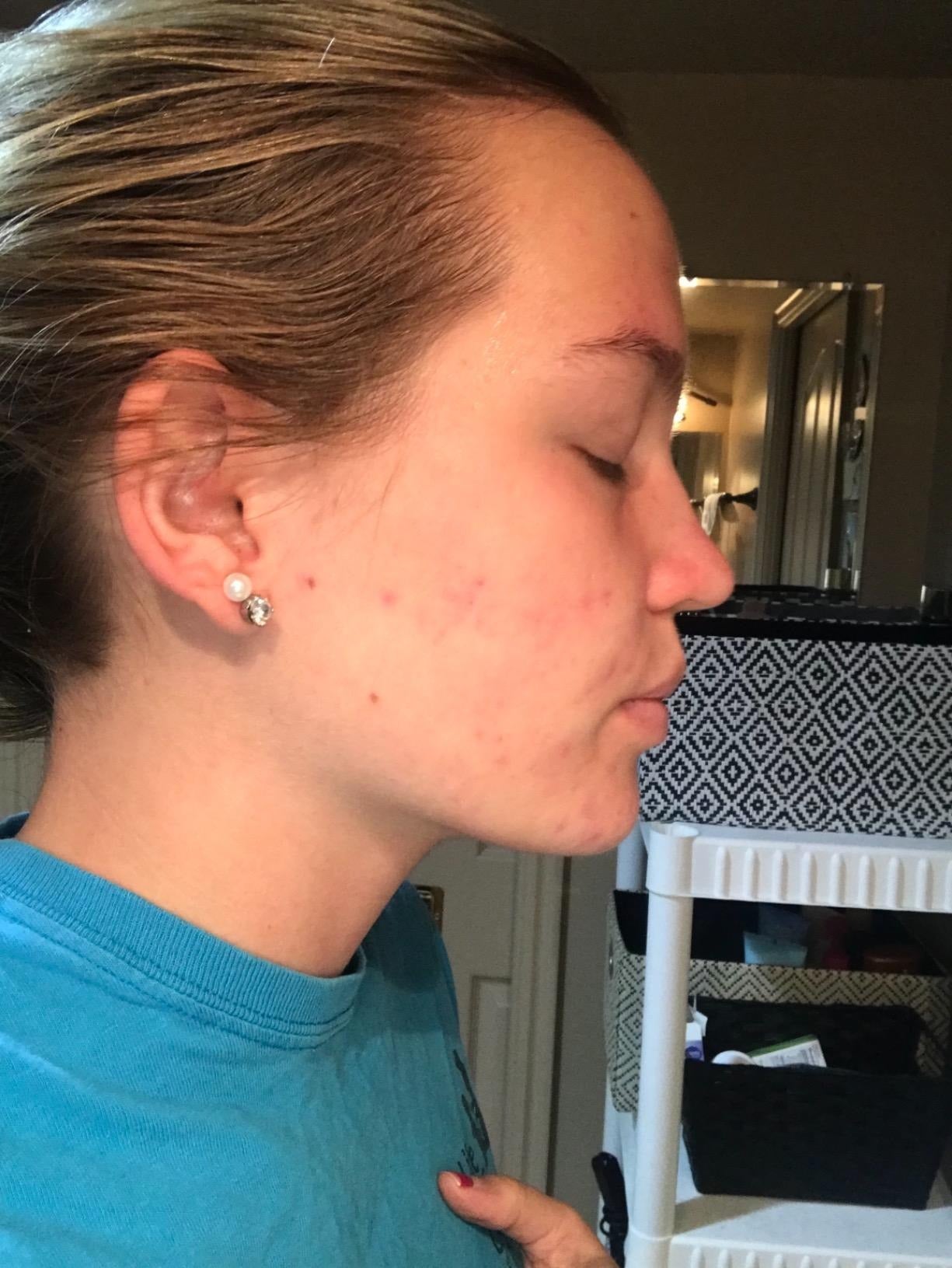 29 Skincare Products Reviewers Called "Staples"