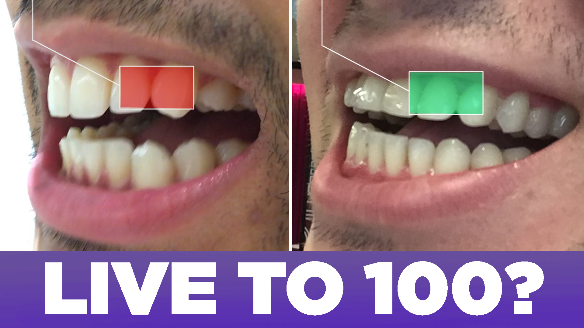 Will You Live To 100 Years Old?