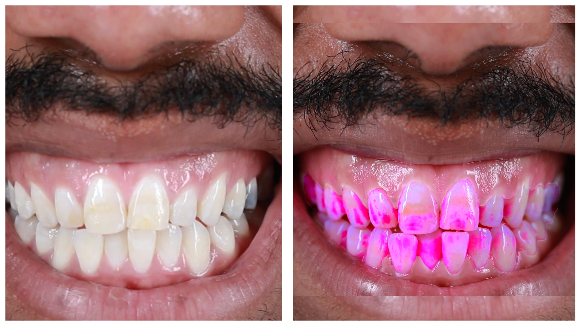 People See How Gross Their Teeth Really Are